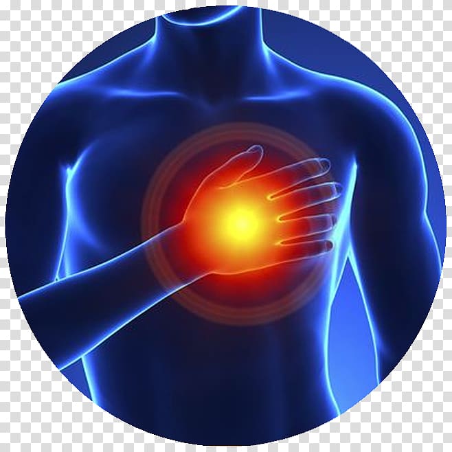 Free: Chest pain Myocardial infarction Heart Cardiology Cardiovascular ...