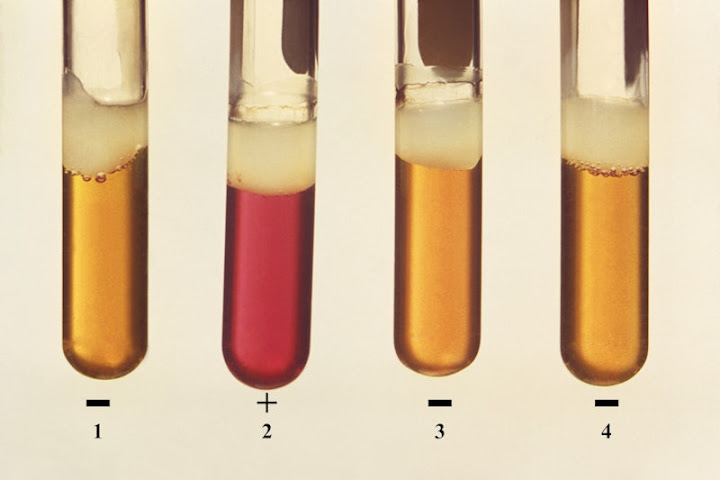 Free: Four test tubes of bacterial | Free Photo - rawpixel - nohat.cc
