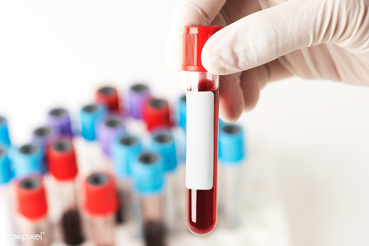 Free: Doctor holding a blood test tube transparent png | Free ...
